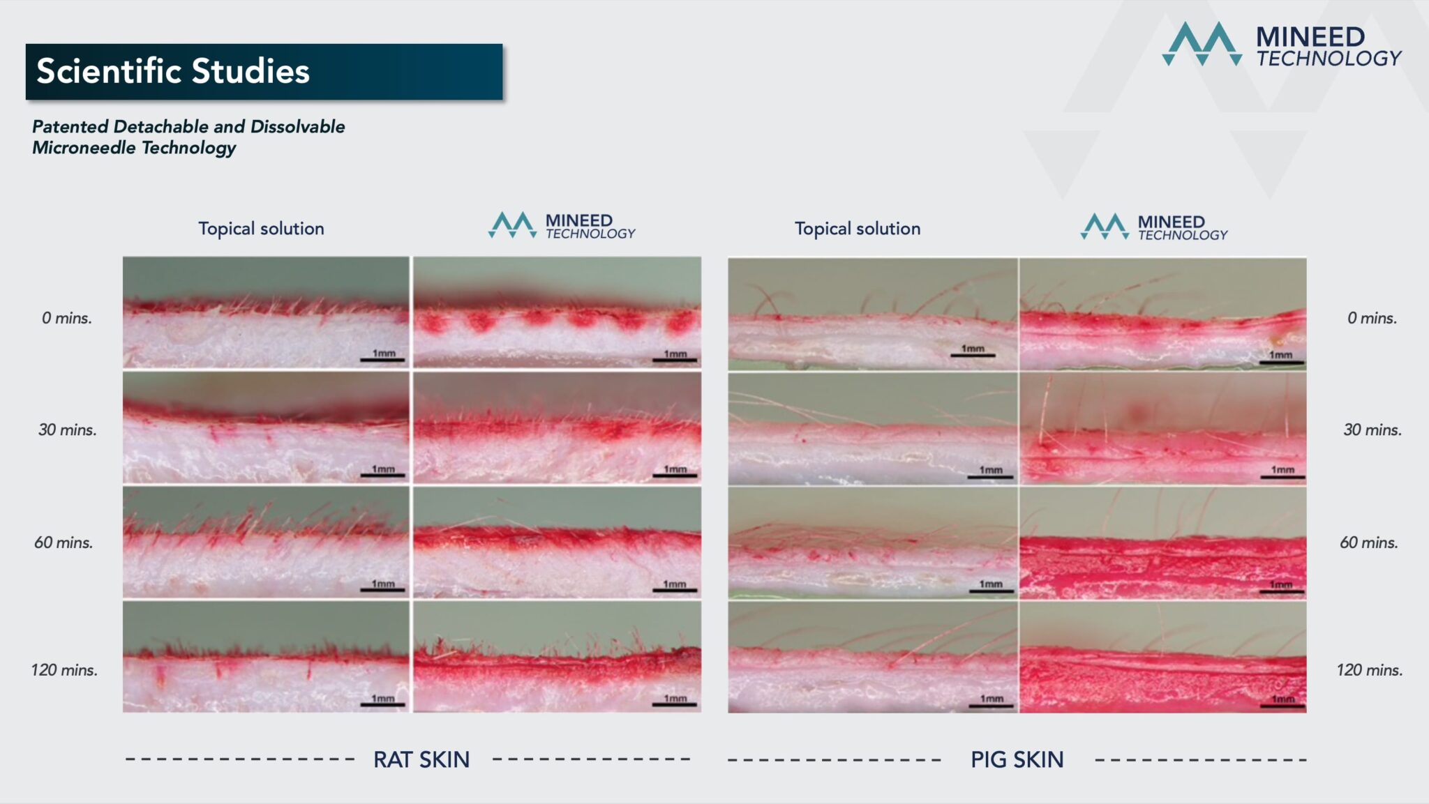 A Painless, Micro Injection that You Can Do Yourself with the Latest ...