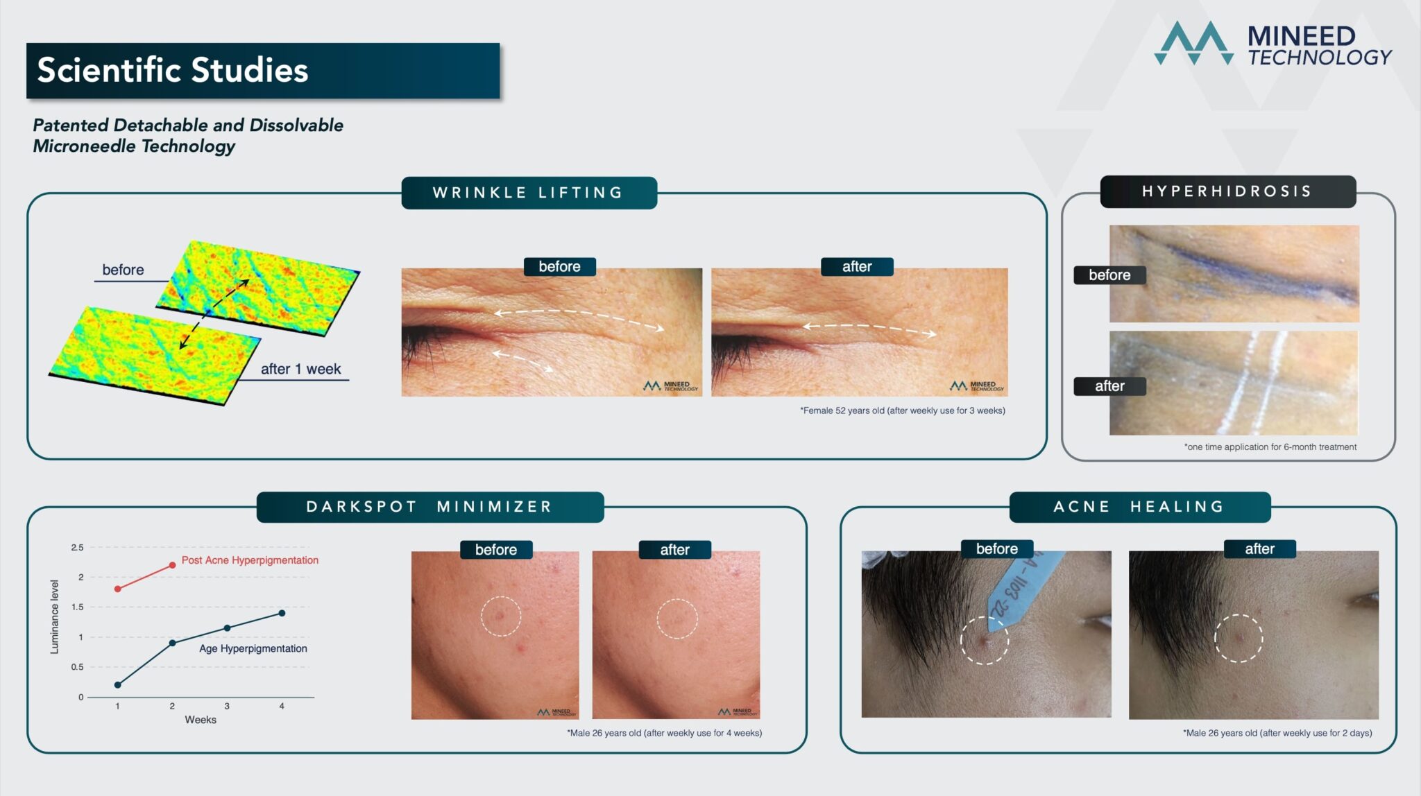 A Painless, Micro Injection that You Can Do Yourself with the Latest ...