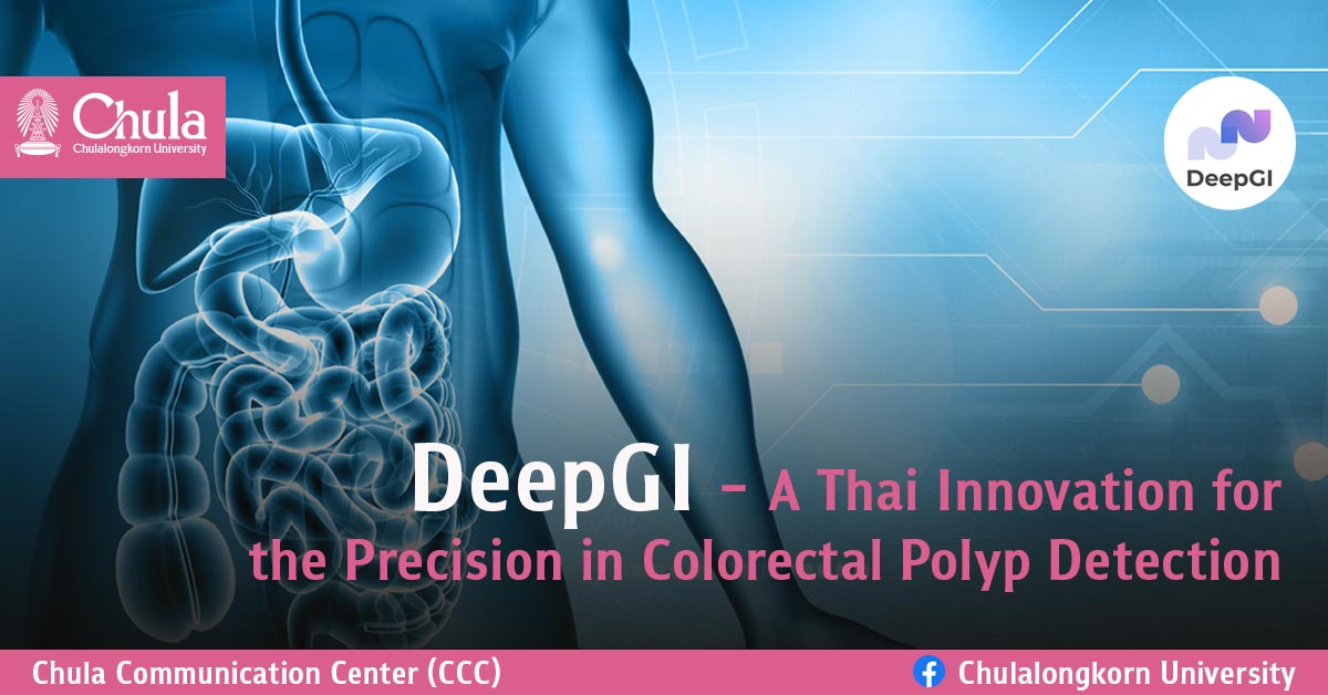 DeepGI - A Thai Innovation for the Precision in Colorectal Polyp ...