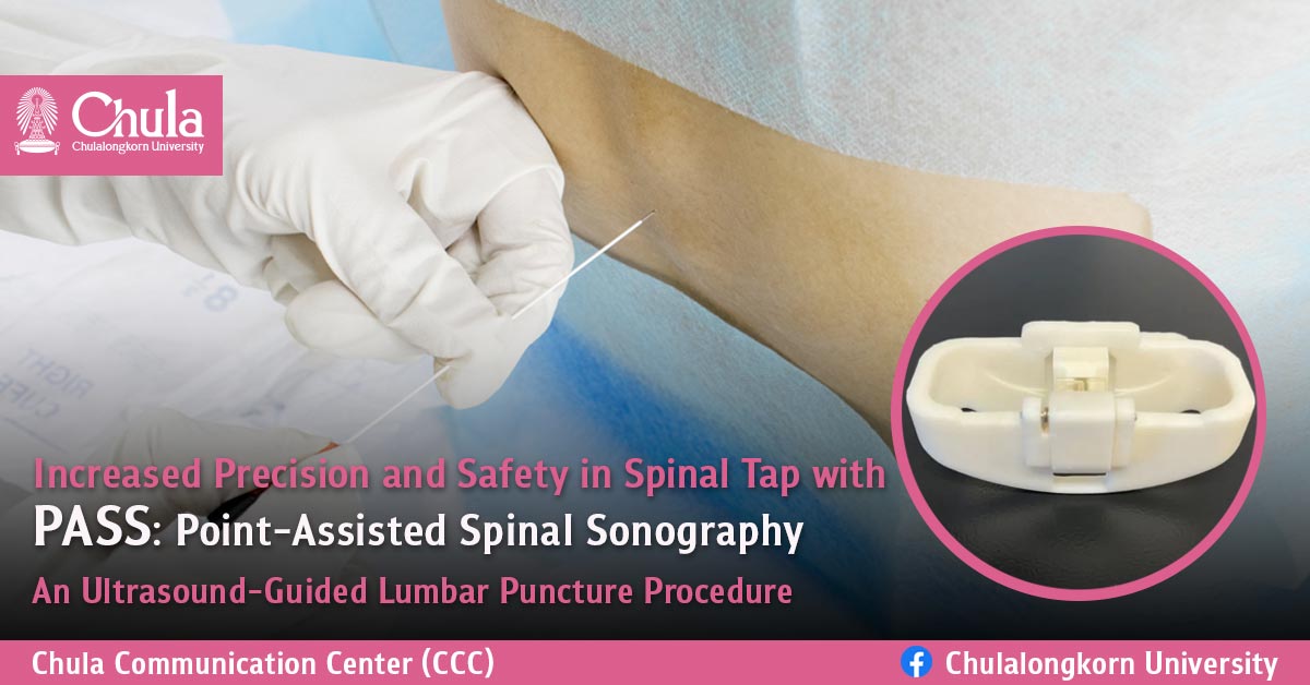PASS (Point-Assisted Spinal Sonography), an ultrasound-guided lumbar ...
