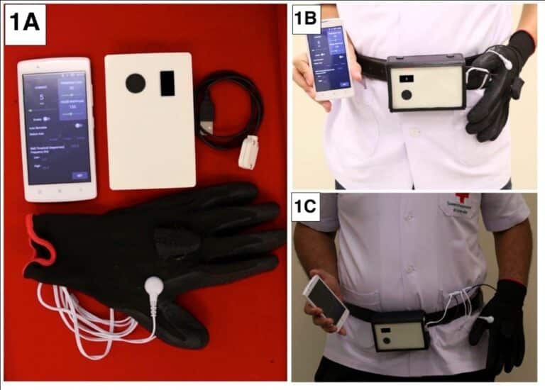 จุฬาฯ เปิดตัวถุงมือพาร์กินสันลดสั่น รุ่นที่5 ใช้ง่าย เบา ลดมือสั่นดี ...