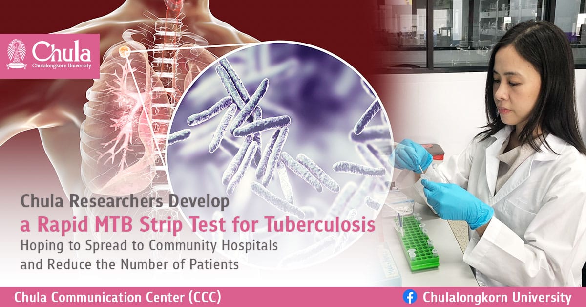 Rapid MTB Strip Test for Tuberculosis – Chulalongkorn University