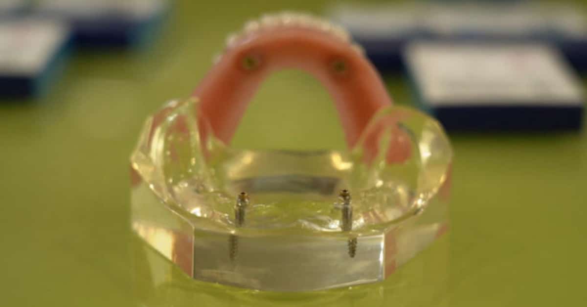 Bills Cut with Thai Artificial Tooth Roots – Chulalongkorn University