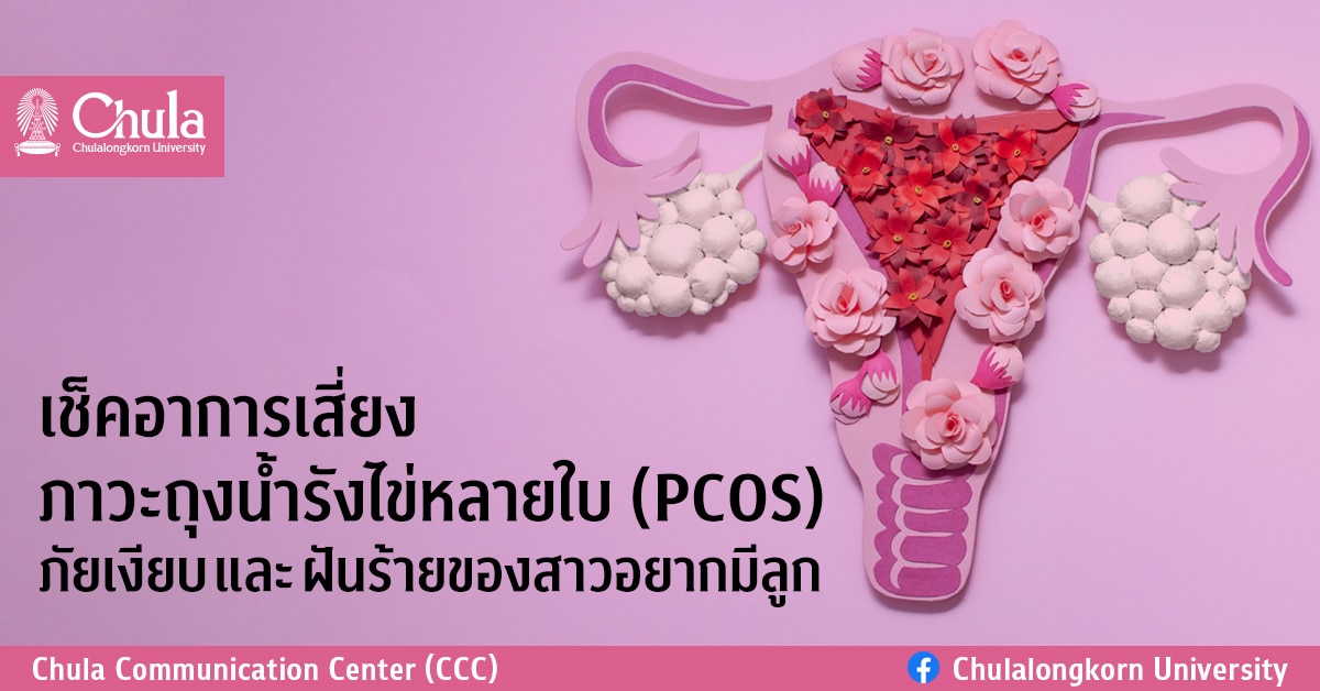 มีลูกยาก สิวเยอะ อ้วน ประจำเดือนไม่ปกติ เสี่ยงเป็น PCOS – จุฬาลงกรณ์มหาวิทยาลัย