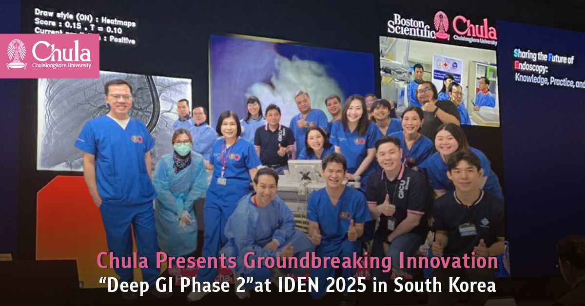 Chula Presents “Deep GI Phase 2” at IDEN 2025 in South Korea ...